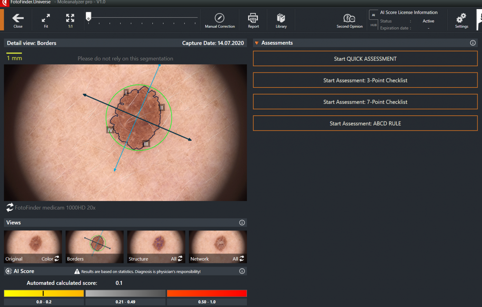 New Mole Mapping Service - Dr. Paul Farrant